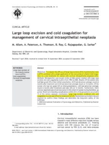 Large loop excision and cold coagulation - Thermo Coagulation